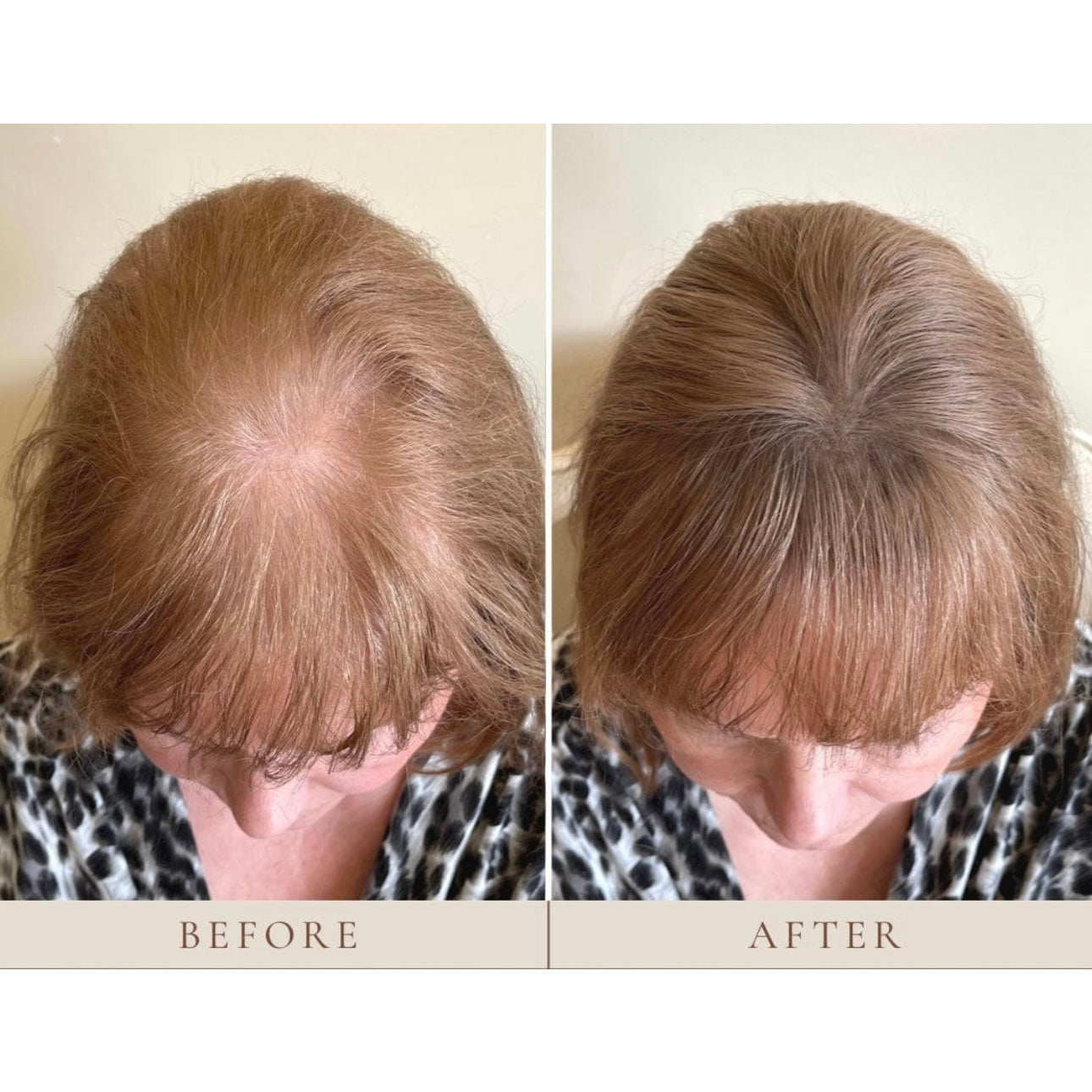 Instant Hairline Scalp-stick – Plume Hair & Lash Science